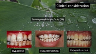 Amelogenesis by dr.suriya visithiriyan | PPTX