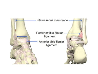 Malleolar fracture | PPTX