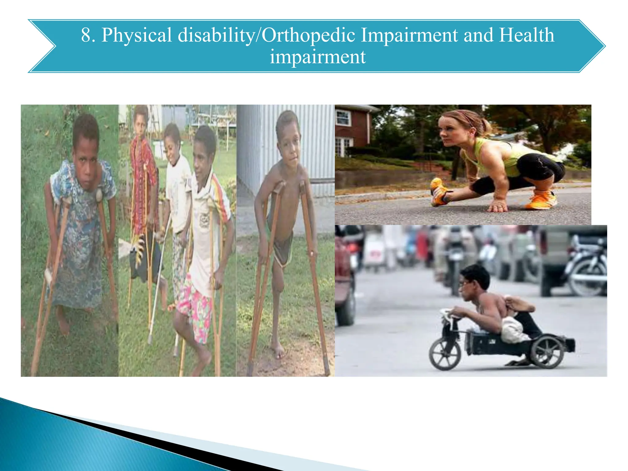 2nd Year Physical Disability.pptx developing.pptx