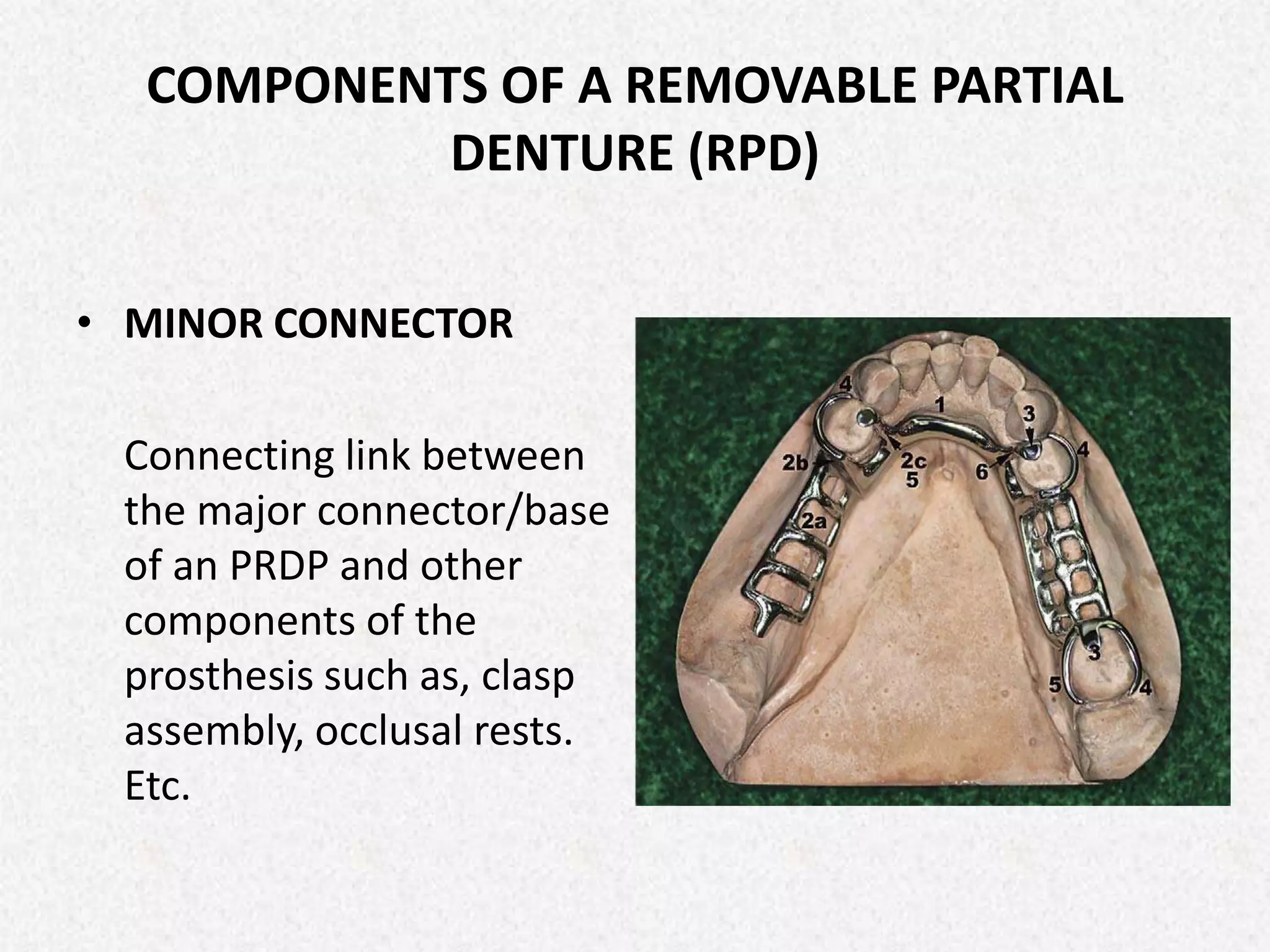 2nd year pre clinical RPD Terminology, Components and Classification of ...