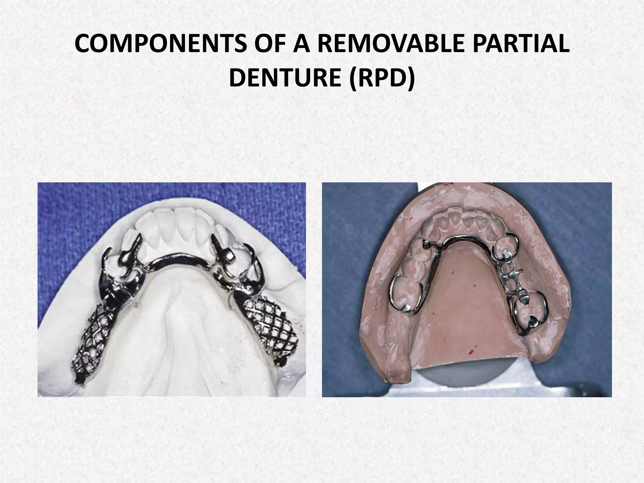 2nd year pre clinical RPD Terminology, Components and Classification of ...