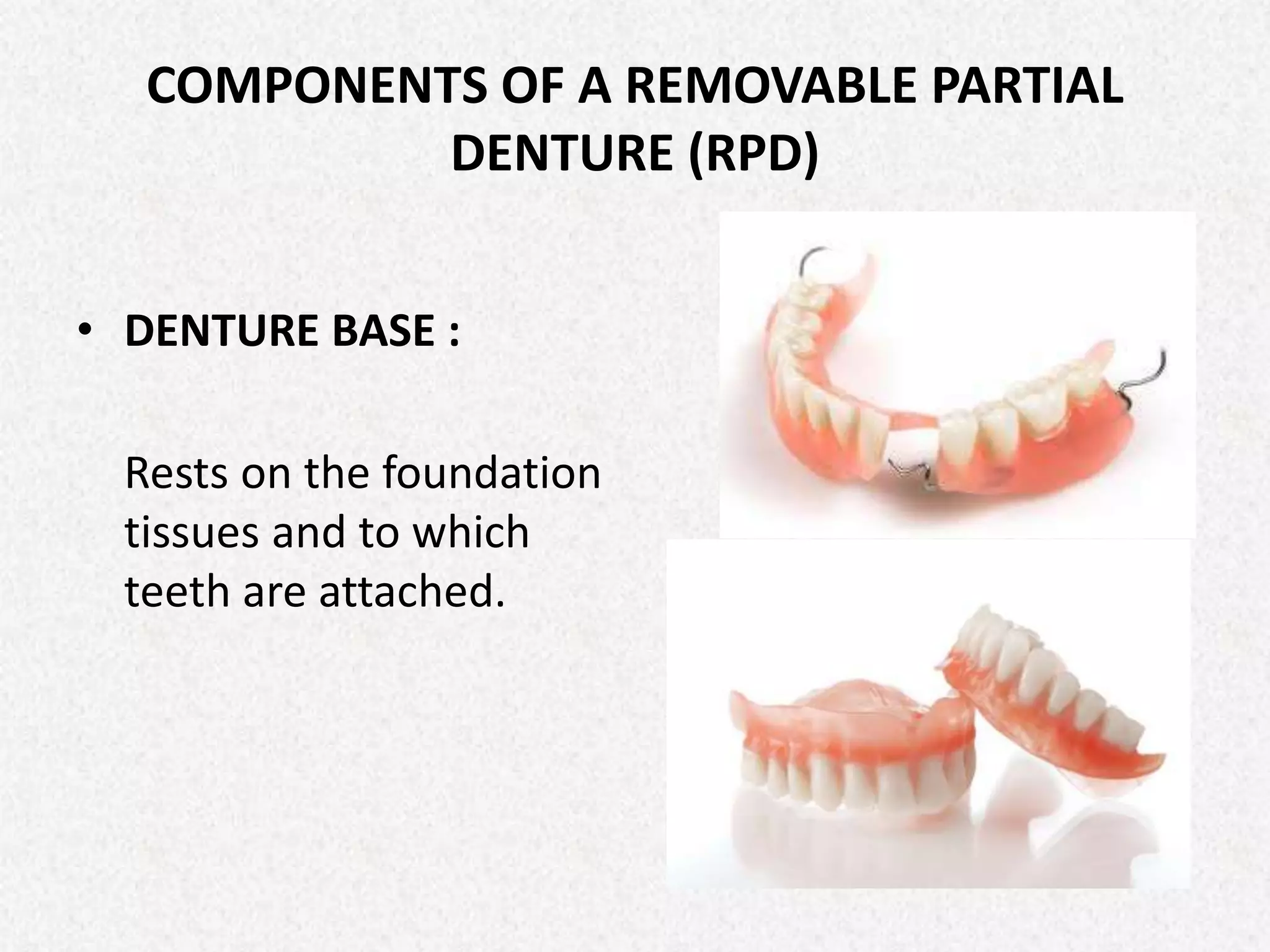 2nd year pre clinical RPD Terminology, Components and Classification of ...