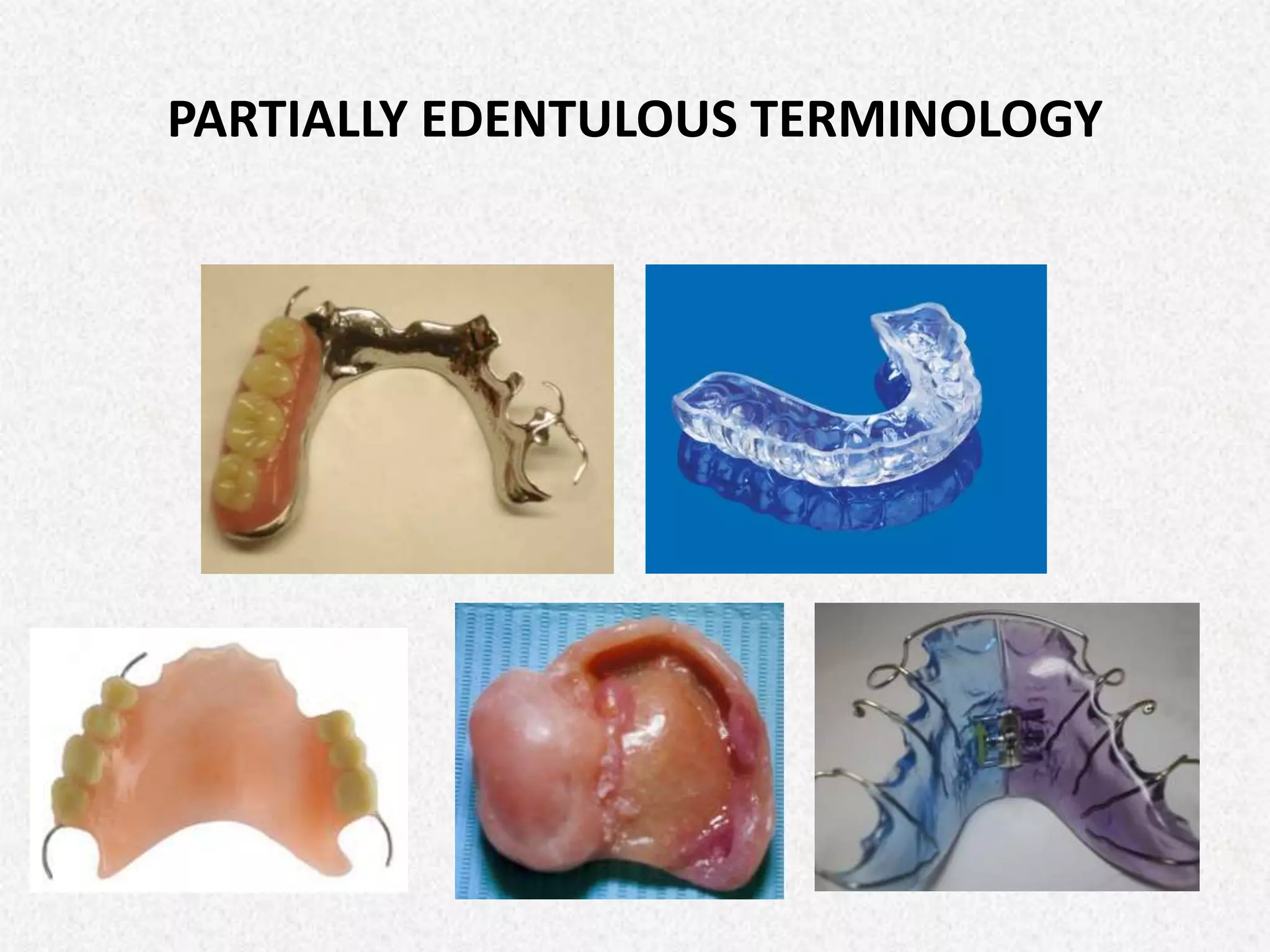 2nd year pre clinical RPD Terminology, Components and Classification of ...