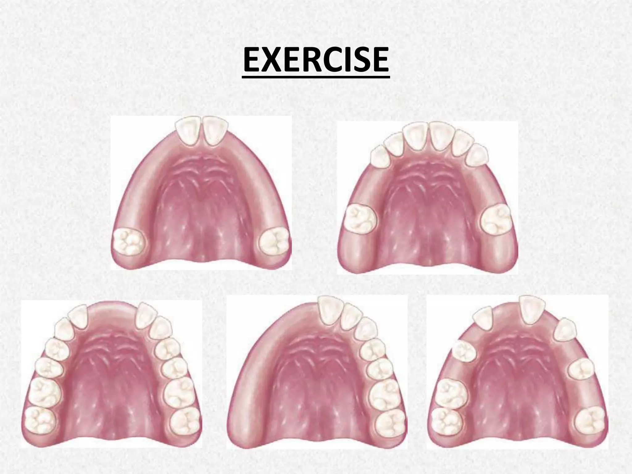2nd year pre clinical RPD Terminology, Components and Classification of ...