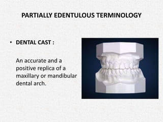 2nd year pre clinical RPD Terminology, Components and Classification of ...