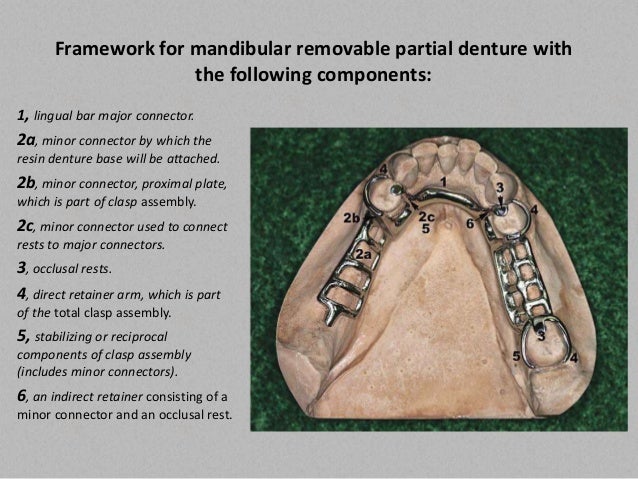2nd year pre clinical RPD Terminology, Components and Classification