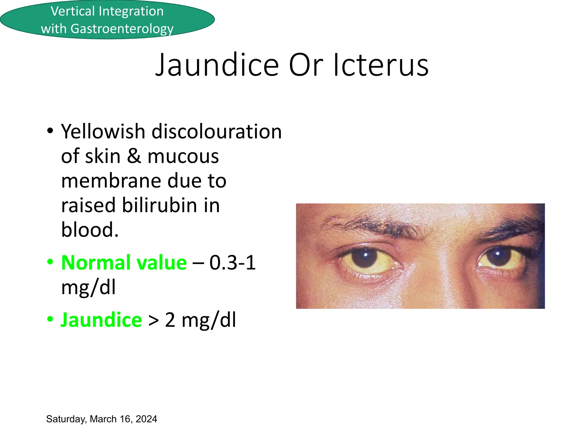 2nd year_SGD_Physiology of Liver & Gallbladder.ppt