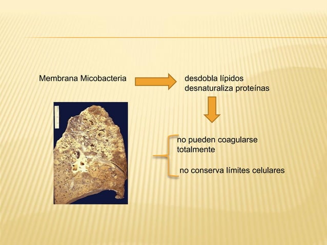2 necrosis caseosa | PDF