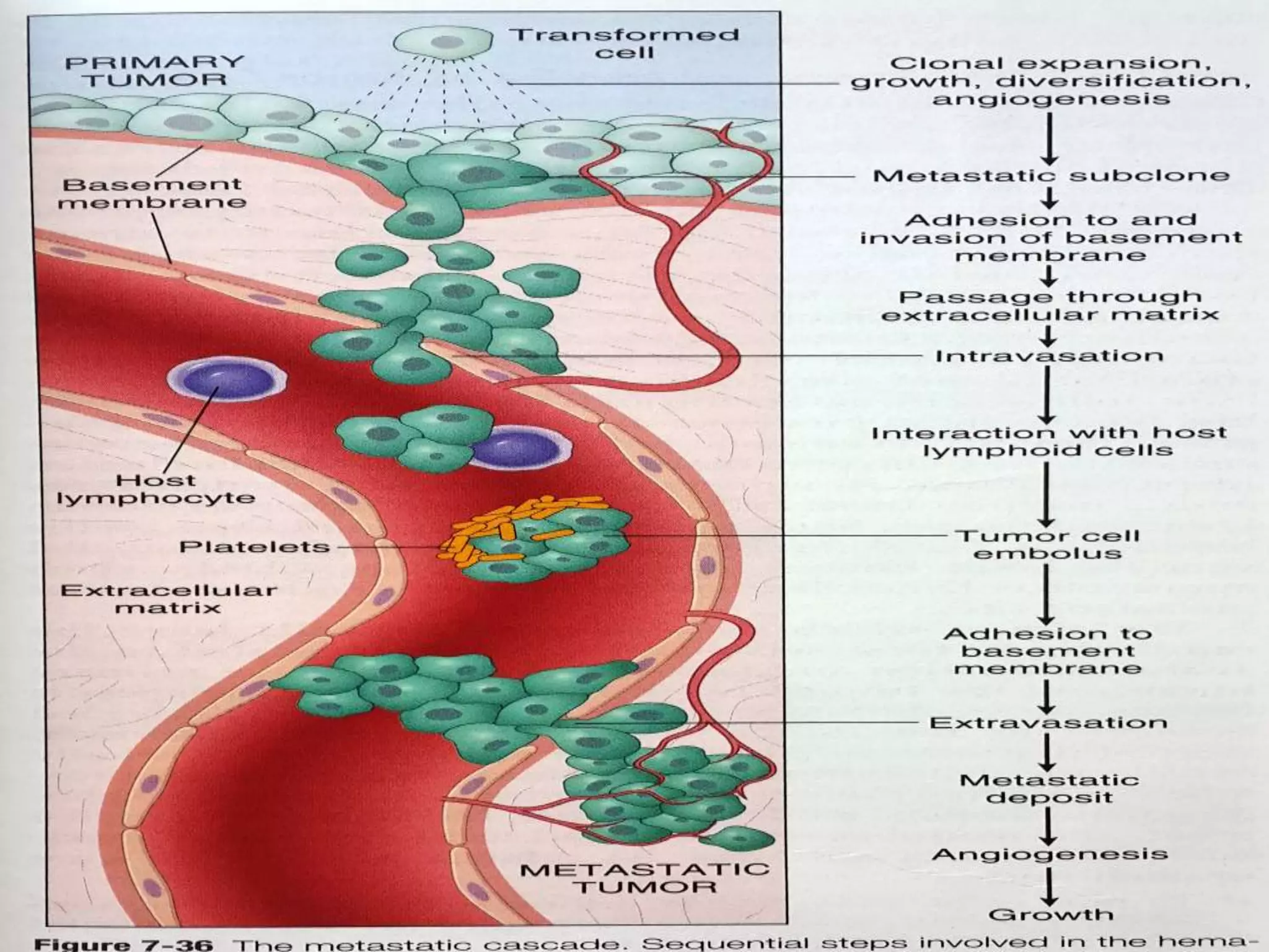 Neoplasia: Metastasis | PPT