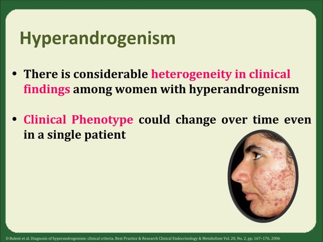 Understanding Hyper-Androgenism: Diagnosis & Management “Through Case ...