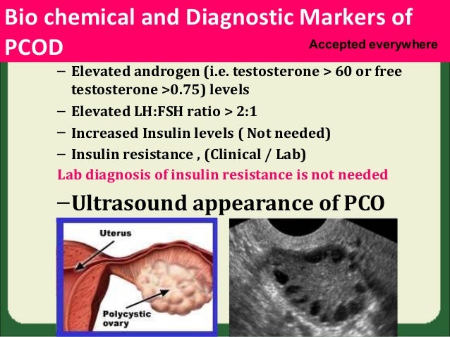 Understanding Hyper-Androgenism: Diagnosis & Management “Through Cas…