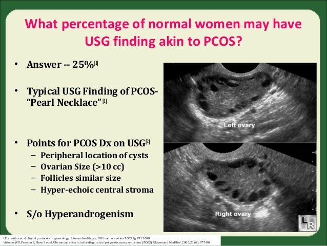 Understanding Hyper-Androgenism: Diagnosis & Management “Through Cas…