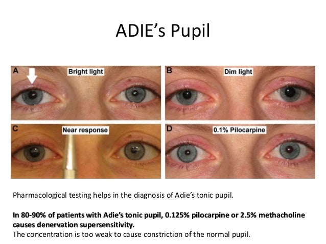 Examination of pupil by pushkar dhir