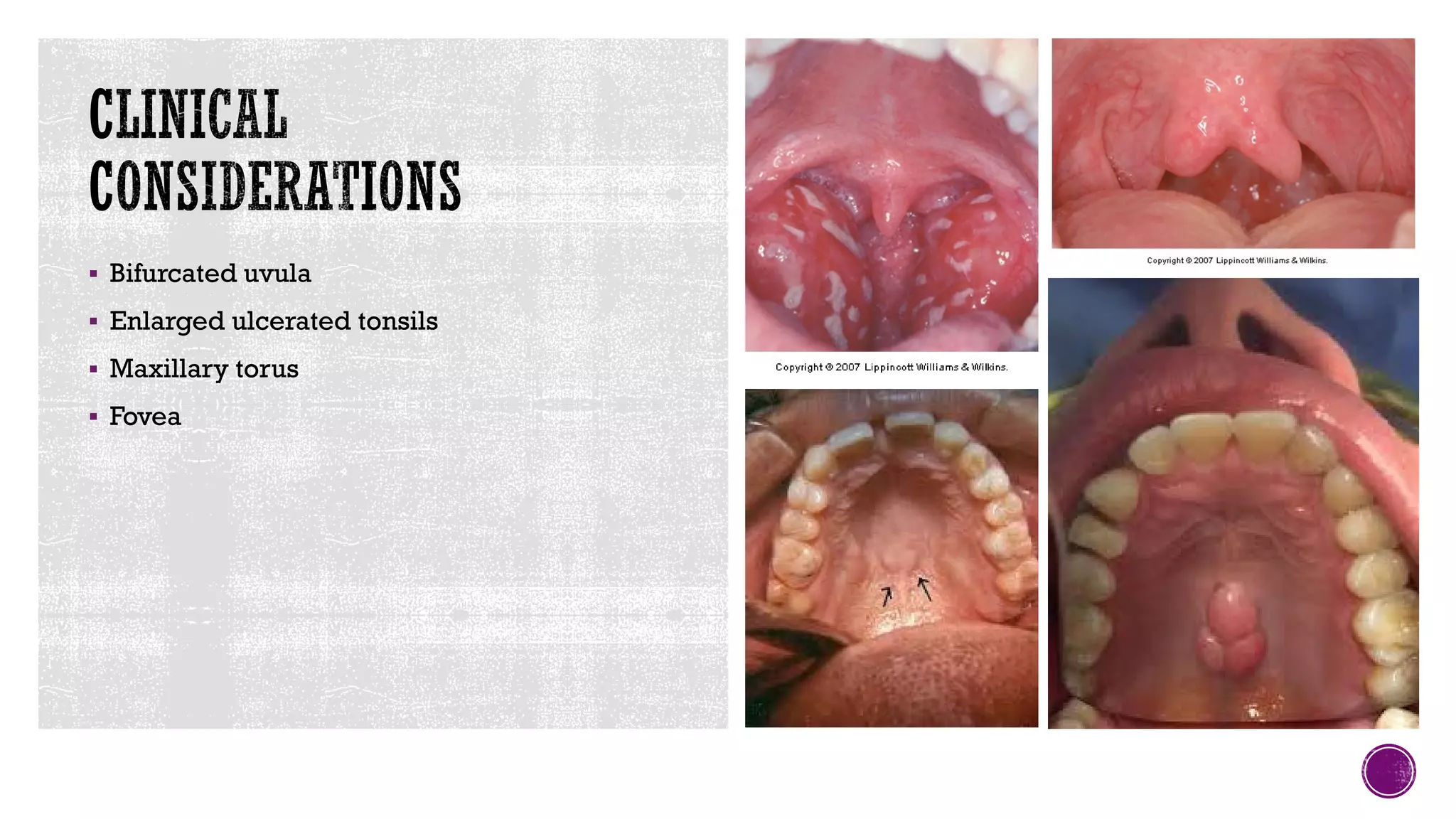 Orofacial Structures | PDF