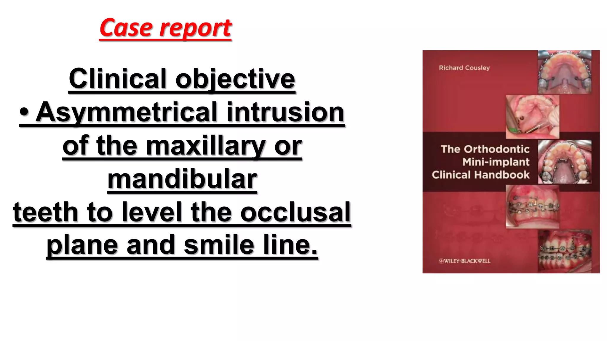 orthodontic correction of canted occlusal plane part 2 | PPTX