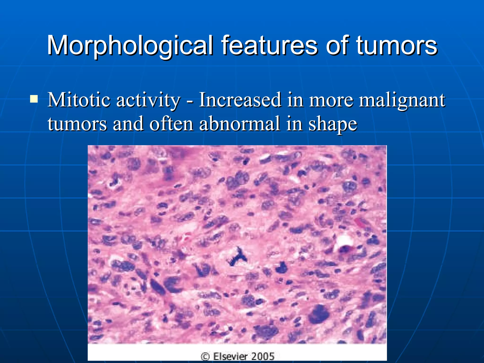2 pathological diagnosis of cancer | PPT