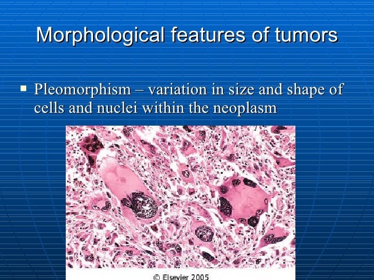 2 pathological diagnosis of cancer