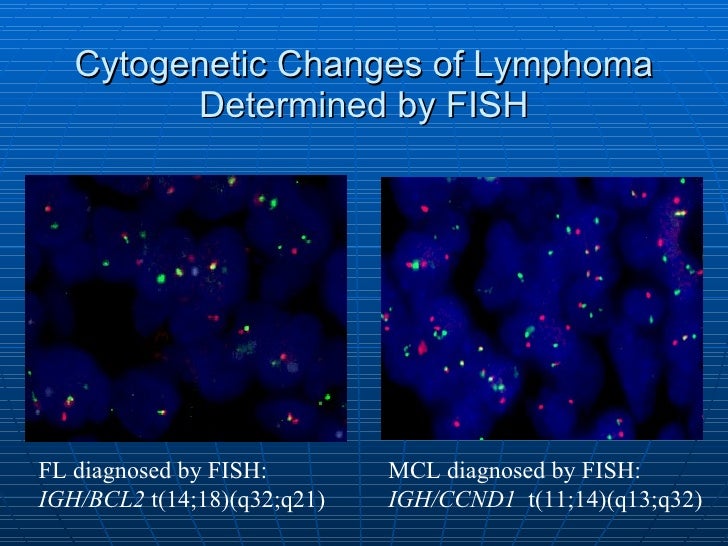 2 pathological diagnosis of cancer