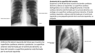 patologia rx tc rmn semiologia corazon art pulmonar y aorta | PDF