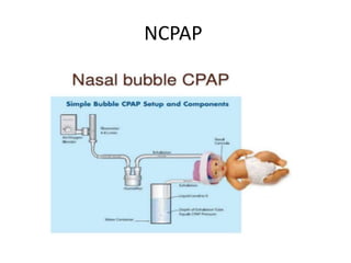 2 pediatric &neonatal mechanical ventilation niv | PPT