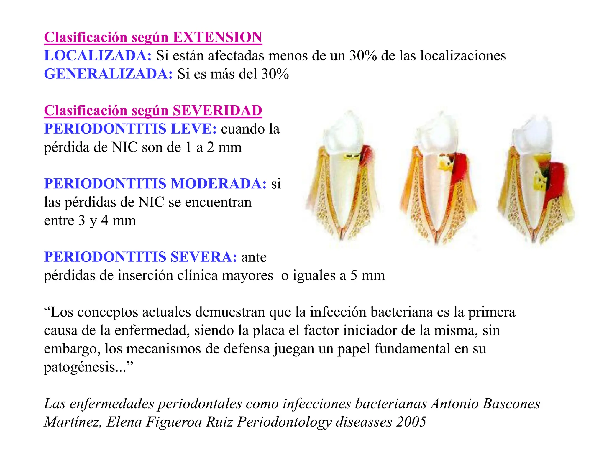 CLASIFICACIÓN DE ENFERMEDAD PERIODONTAL.pdf