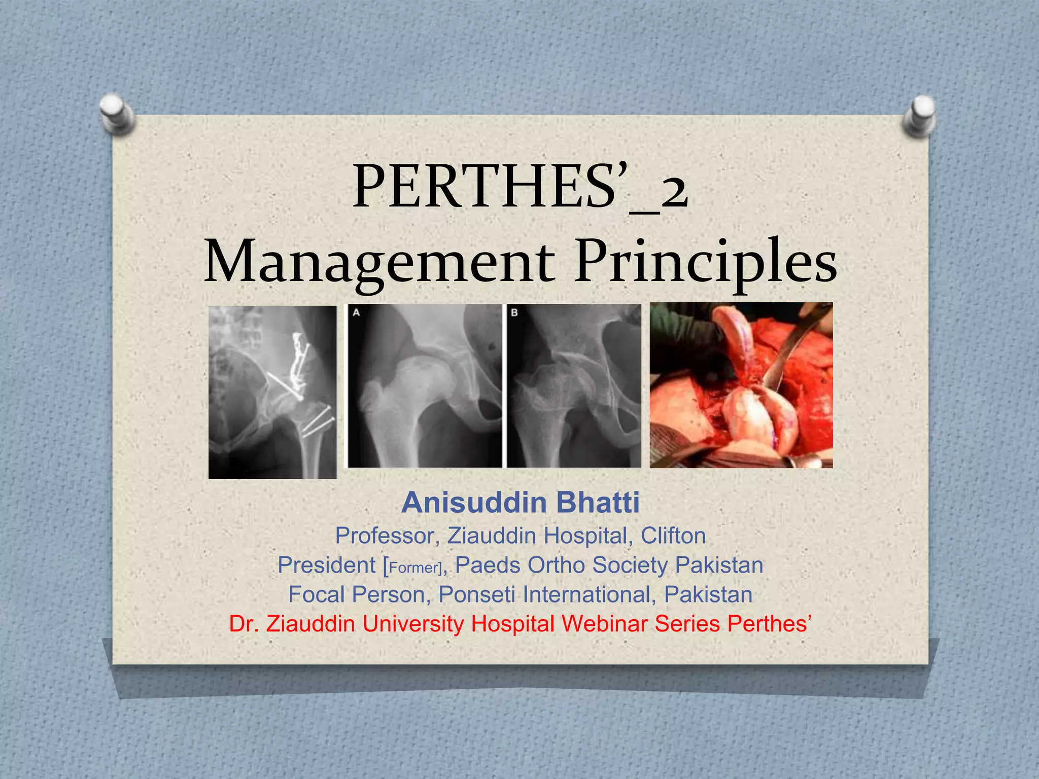 LCPD Perthes'_ management | PPTX