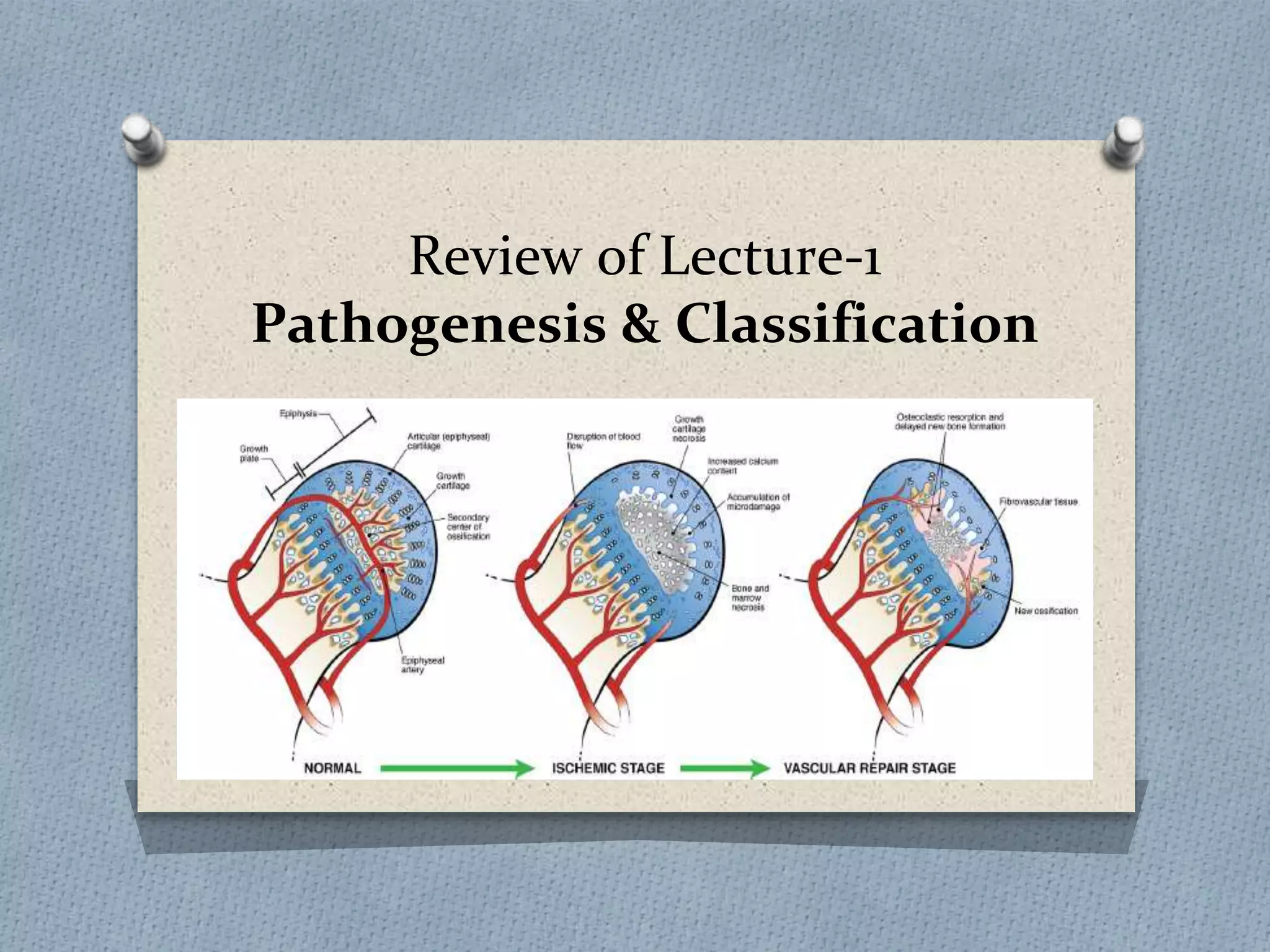 LCPD Perthes'_ management | PPTX