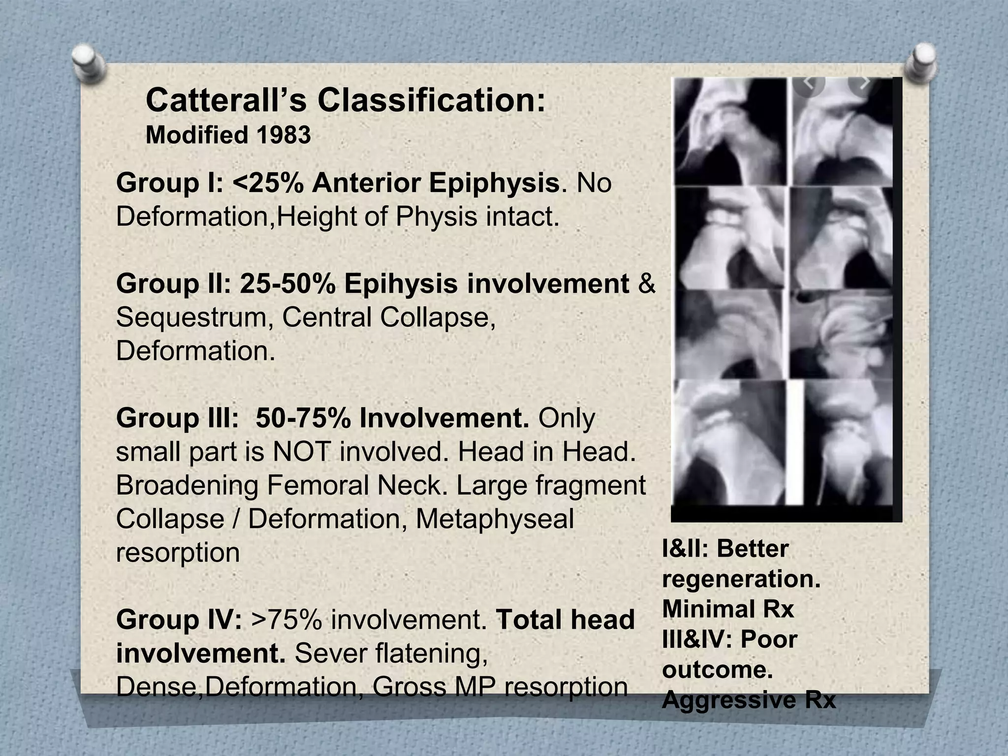 LCPD Perthes'_ management | PPTX