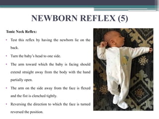 2 Physiological Adaptation of the Newborn .pptx