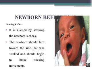 2 Physiological Adaptation of the Newborn .pptx