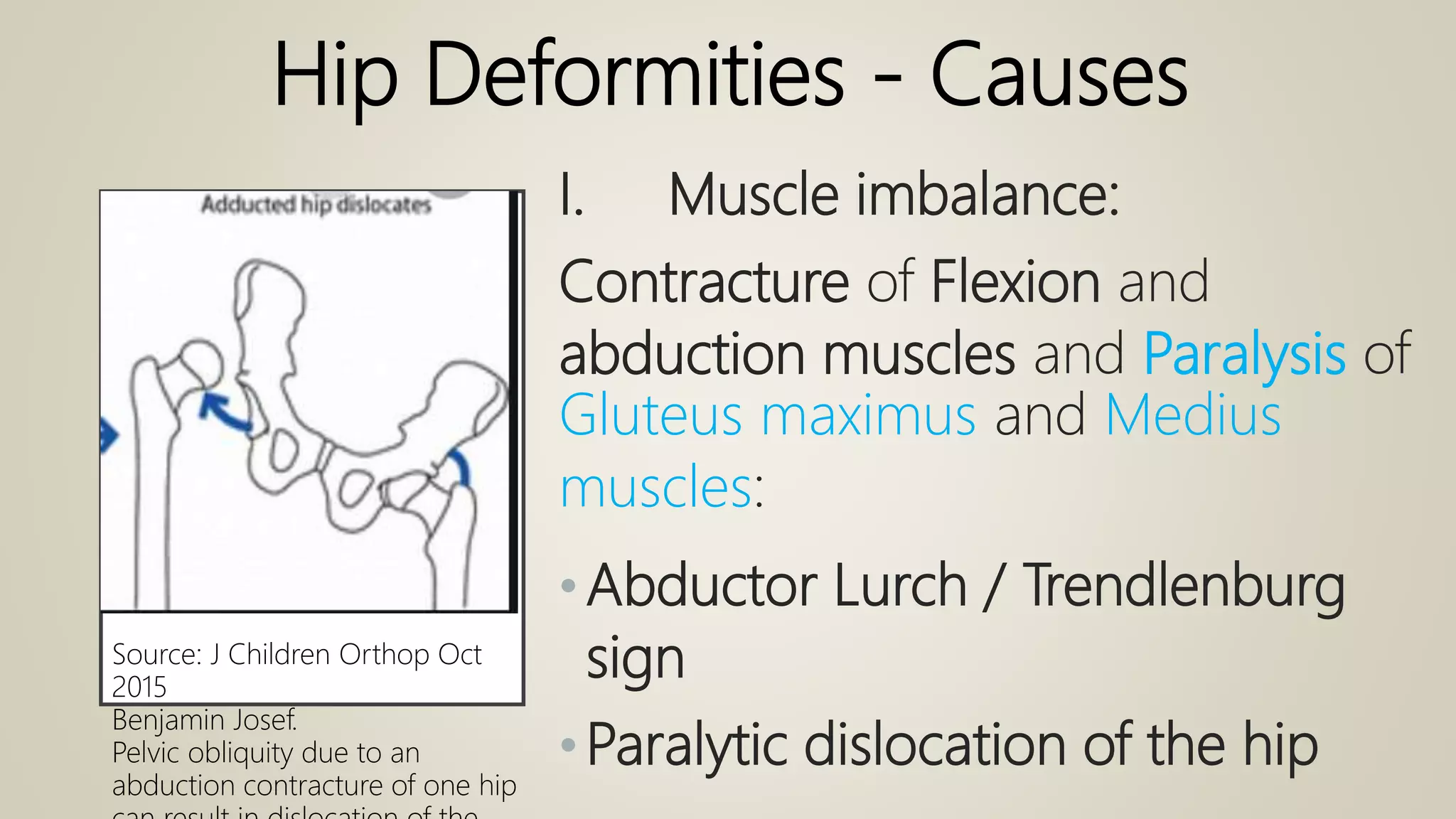 PostPolio Residual Paralysis part2 lower limb | PPTX