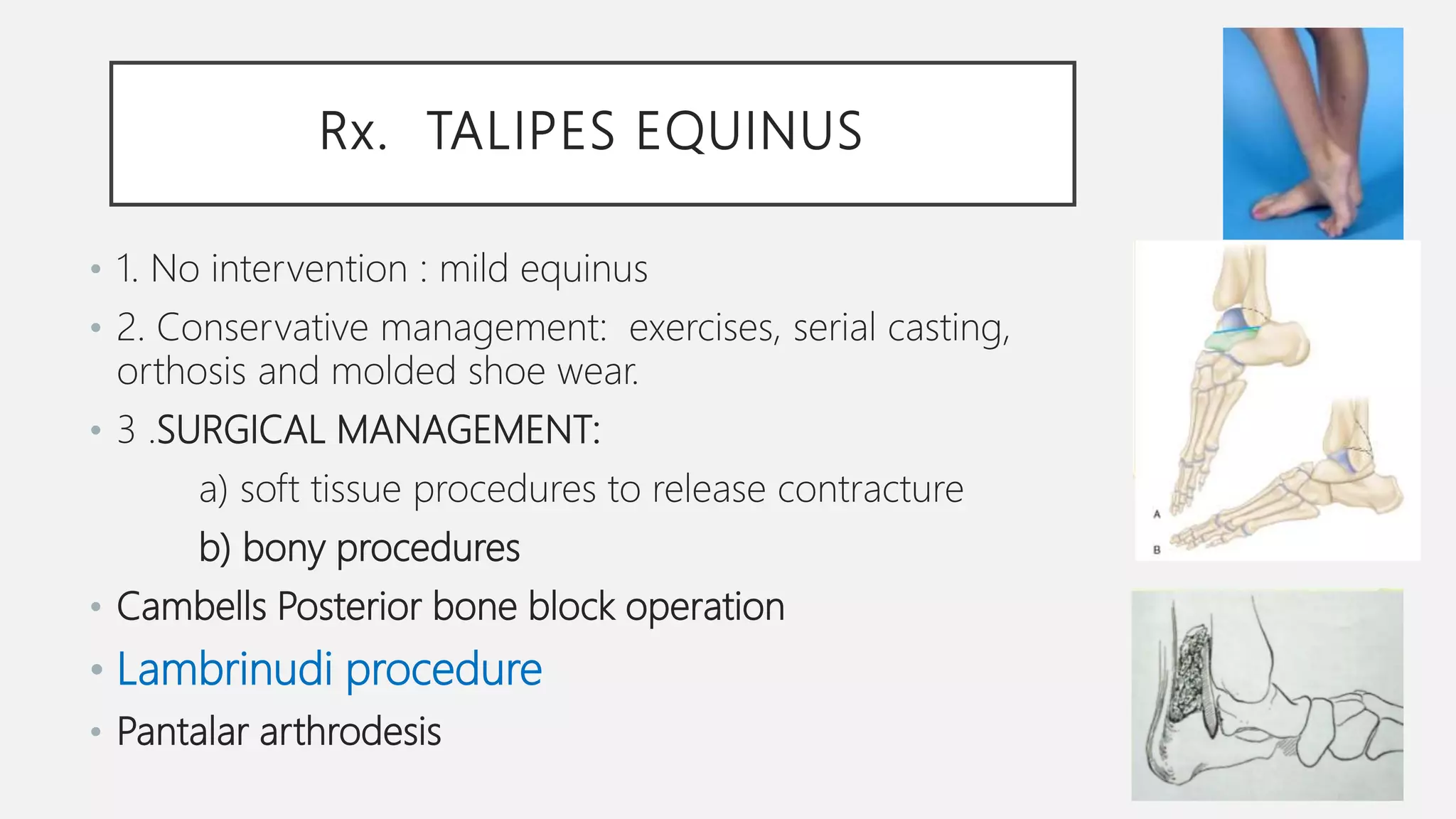 PostPolio Residual Paralysis part2 lower limb | PPTX