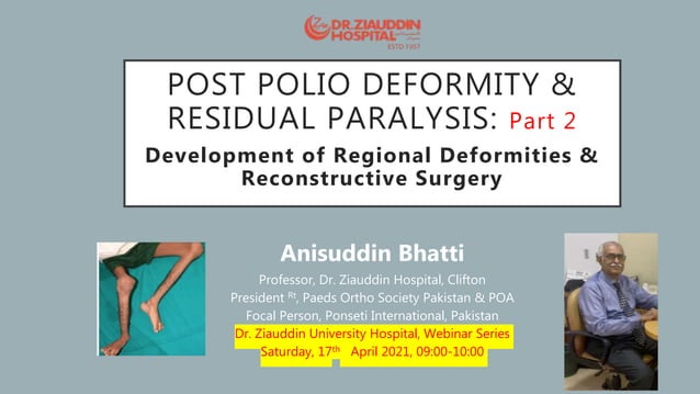 PostPolio Residual Paralysis part2 lower limb | PPT