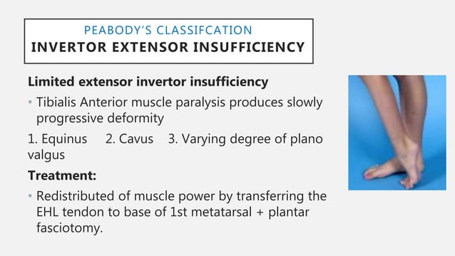 PostPolio Residual Paralysis part2 lower limb | PPT