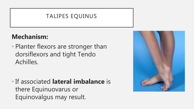 PostPolio Residual Paralysis part2 lower limb | PPT