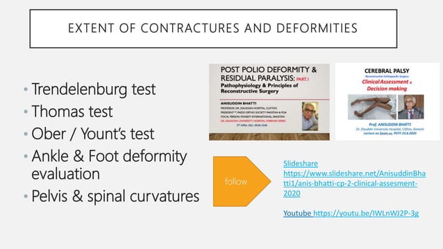 PostPolio Residual Paralysis part2 lower limb | PPT