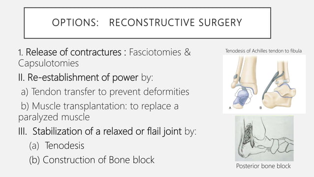 PostPolio Residual Paralysis part2 lower limb | PPT