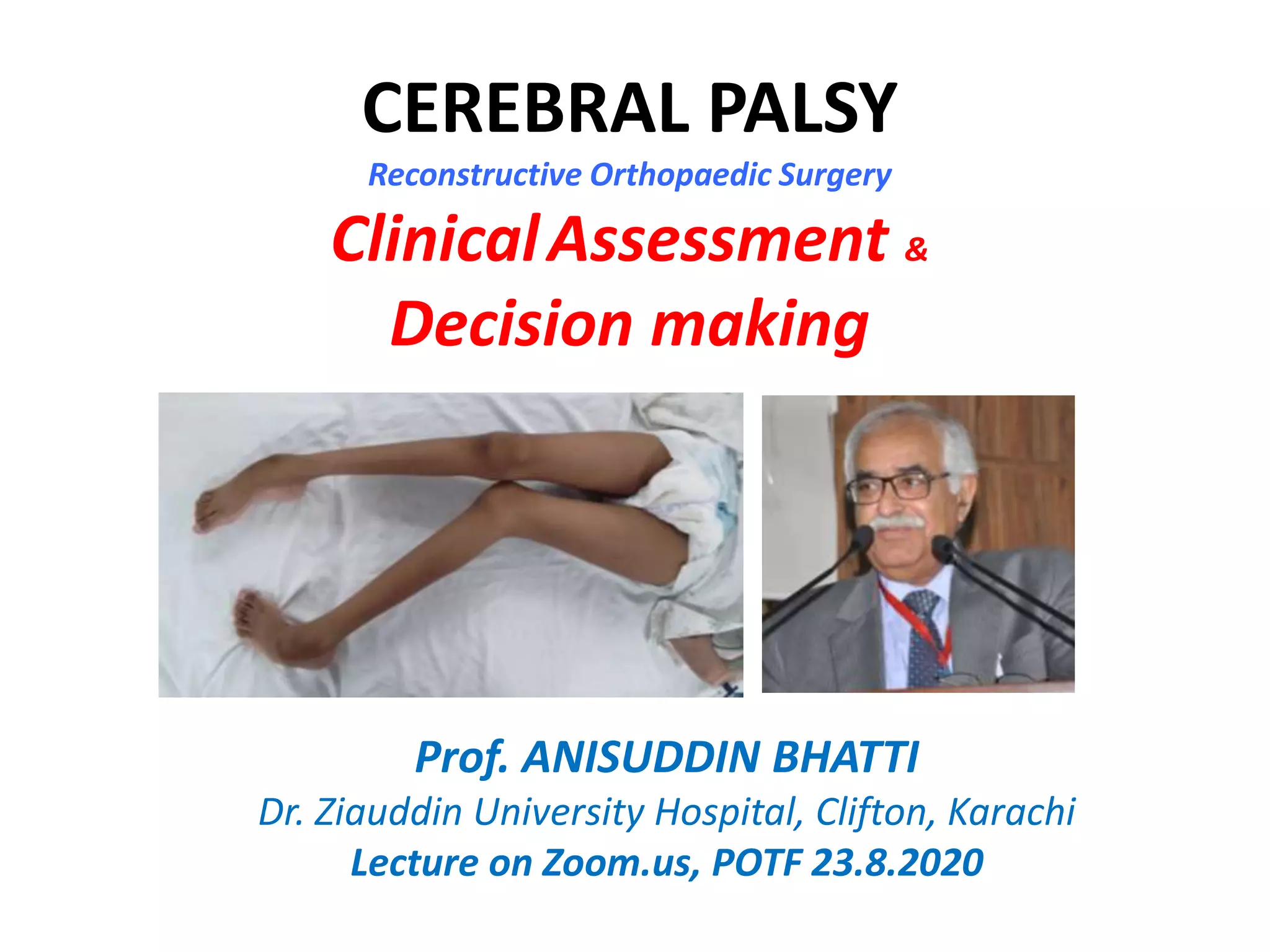 Prof. Anisuddin Bhatti Cerebral Palsy case Orthopaedic Examination ...