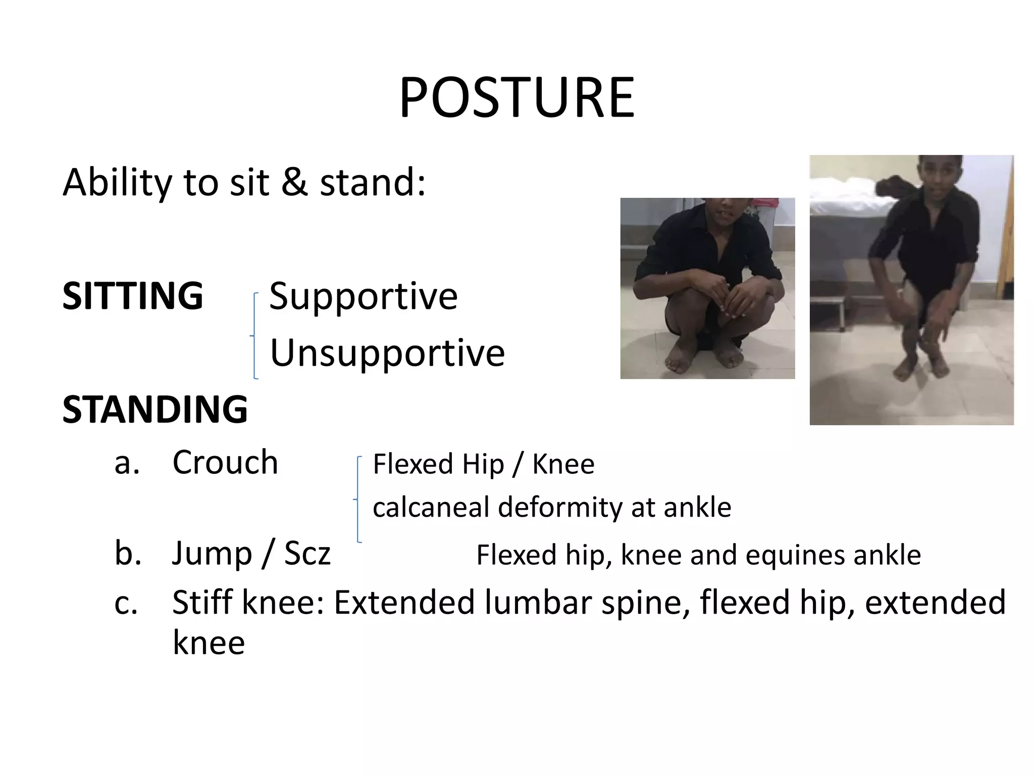 Prof. Anisuddin Bhatti Cerebral Palsy case Orthopaedic Examination ...