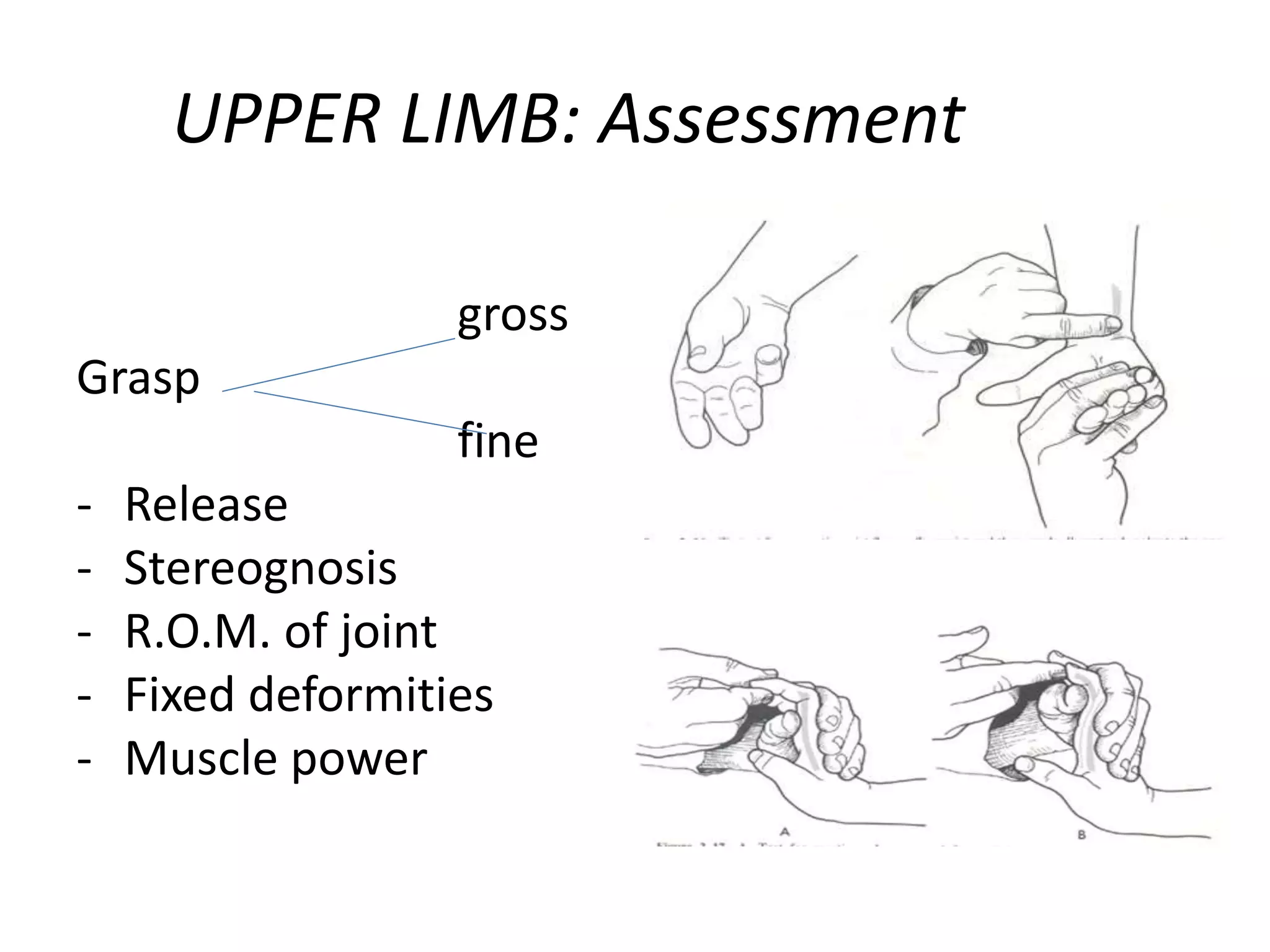 Prof. Anisuddin Bhatti Cerebral Palsy case Orthopaedic Examination ...