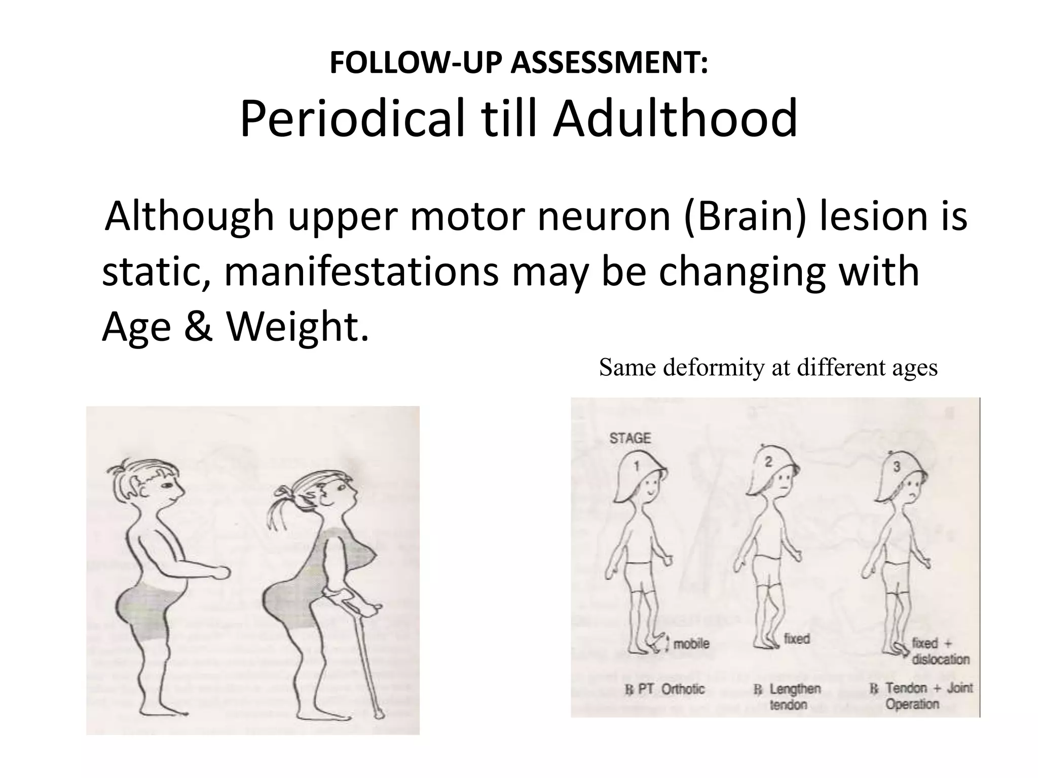 Prof. Anisuddin Bhatti Cerebral Palsy case Orthopaedic Examination ...