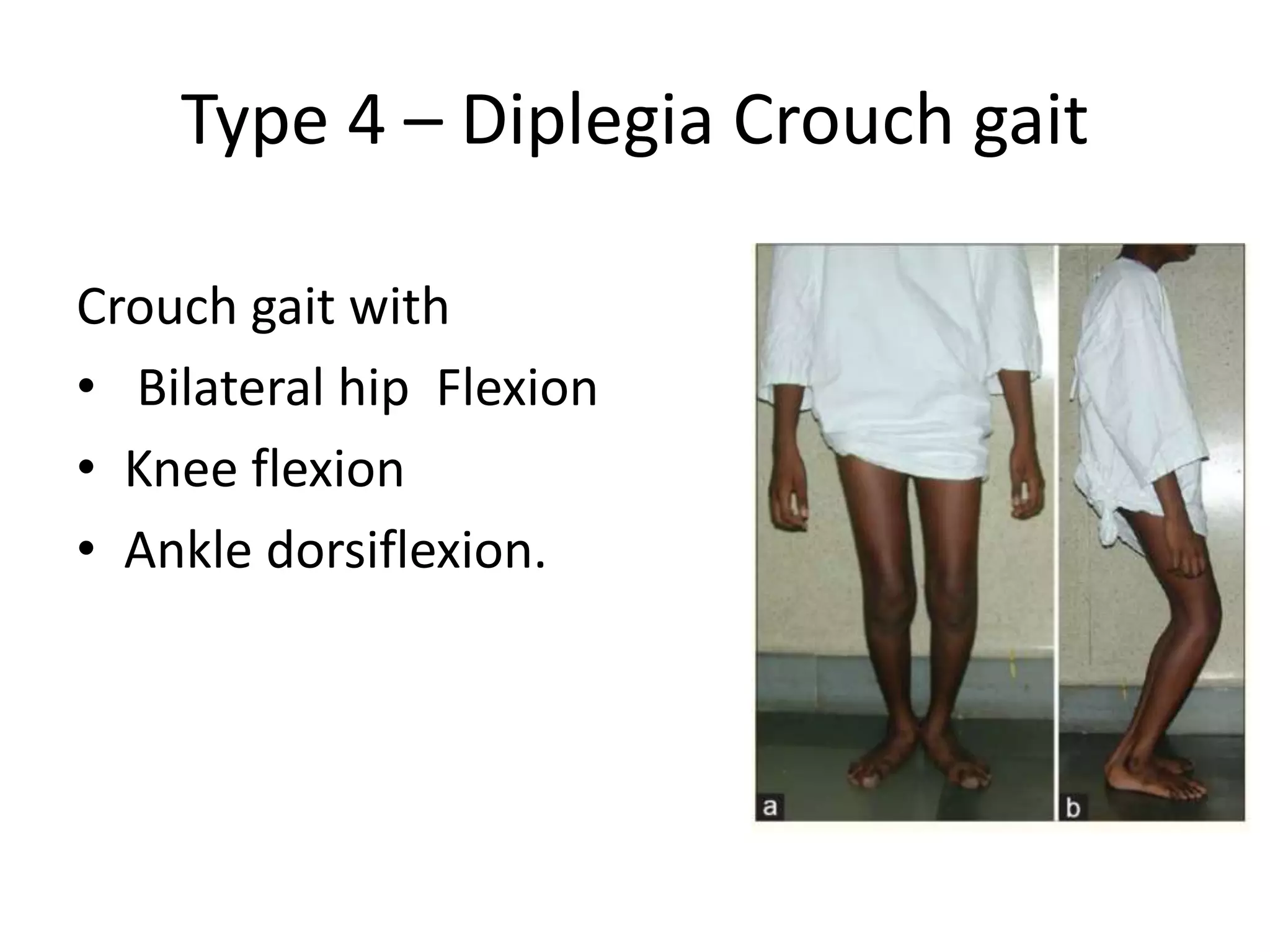 Prof. Anisuddin Bhatti Cerebral Palsy case Orthopaedic Examination ...