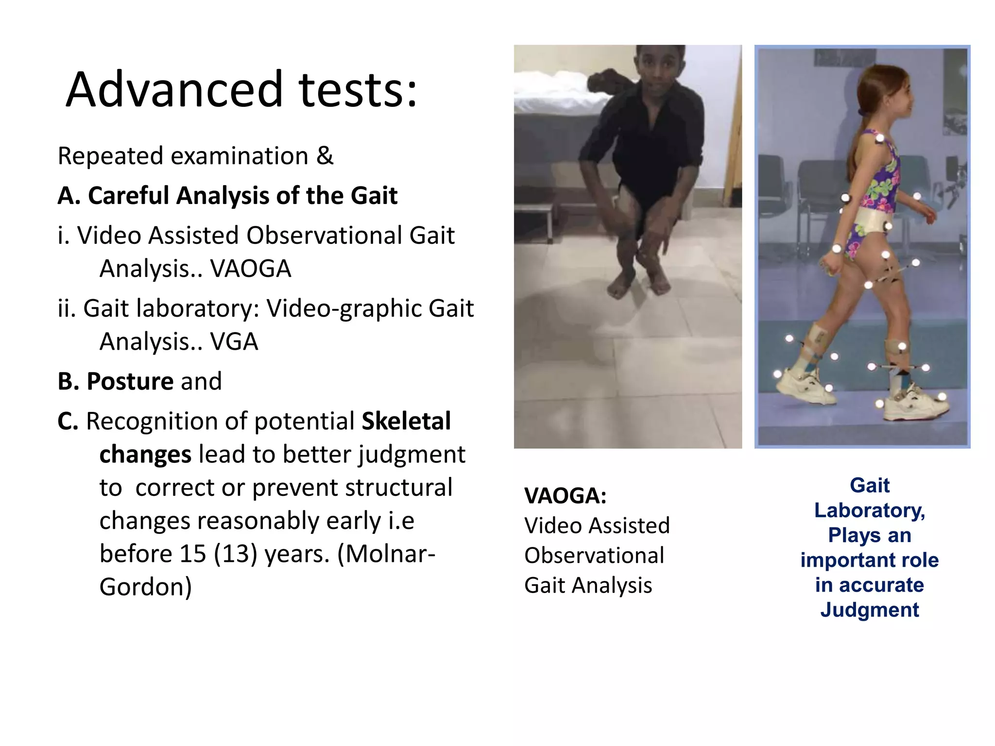 Prof. Anisuddin Bhatti Cerebral Palsy case Orthopaedic Examination ...
