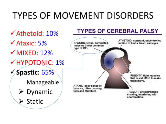Prof. Anisuddin Bhatti Cerebral Palsy case Orthopaedic Examination ...