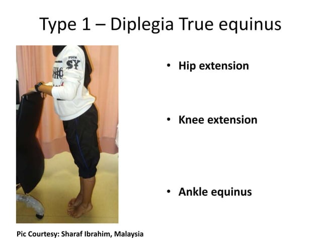 Prof. Anisuddin Bhatti Cerebral Palsy case Orthopaedic Examination ...
