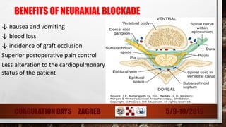 Neuroaxial block in patients in anticoagulants | PDF