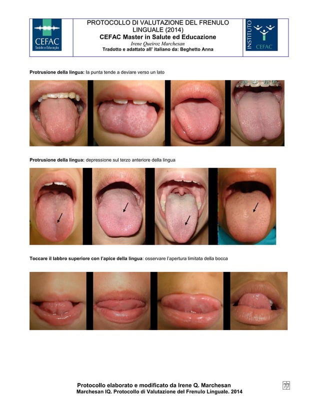 2 protocollo marchesan frenulo 2014 | PDF | Ear, Nose and Throat ...