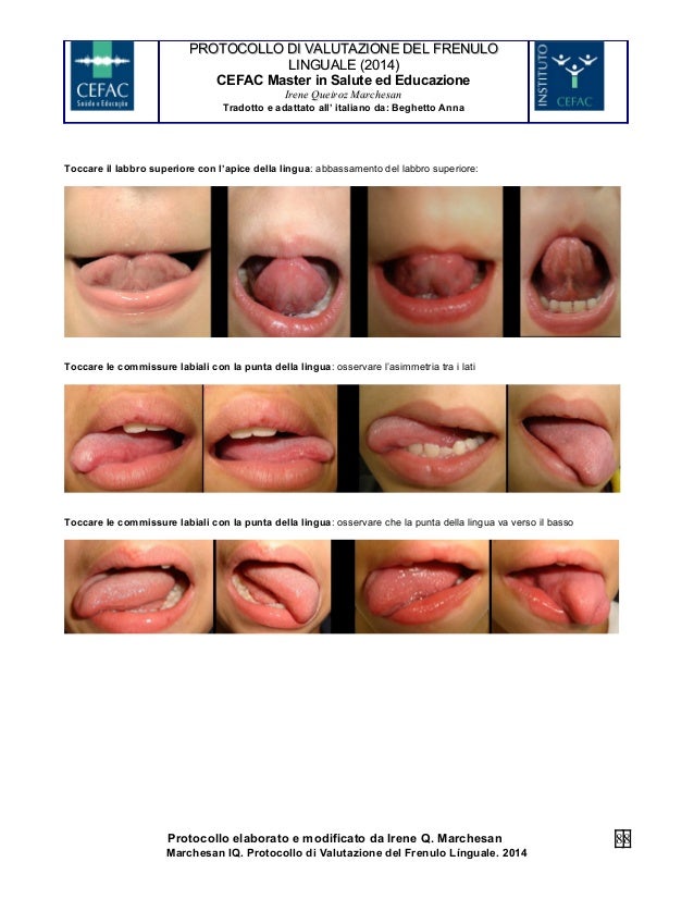 2 protocollo marchesan frenulo 2014