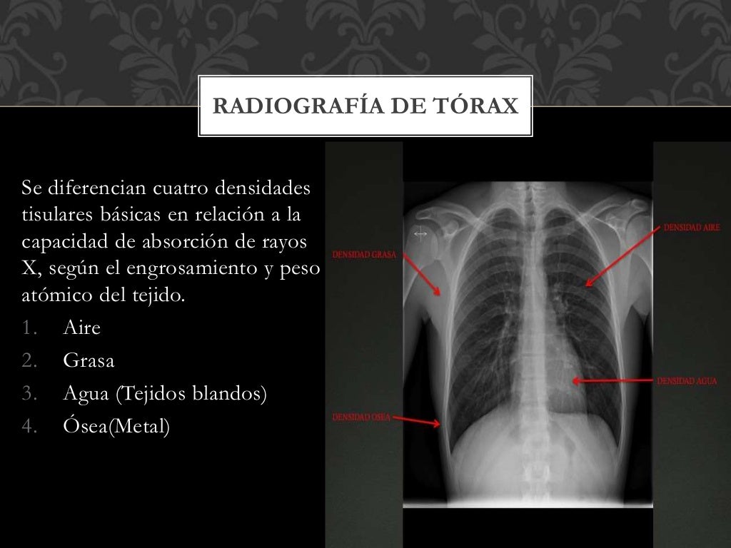 Proyecciones Radiologicas