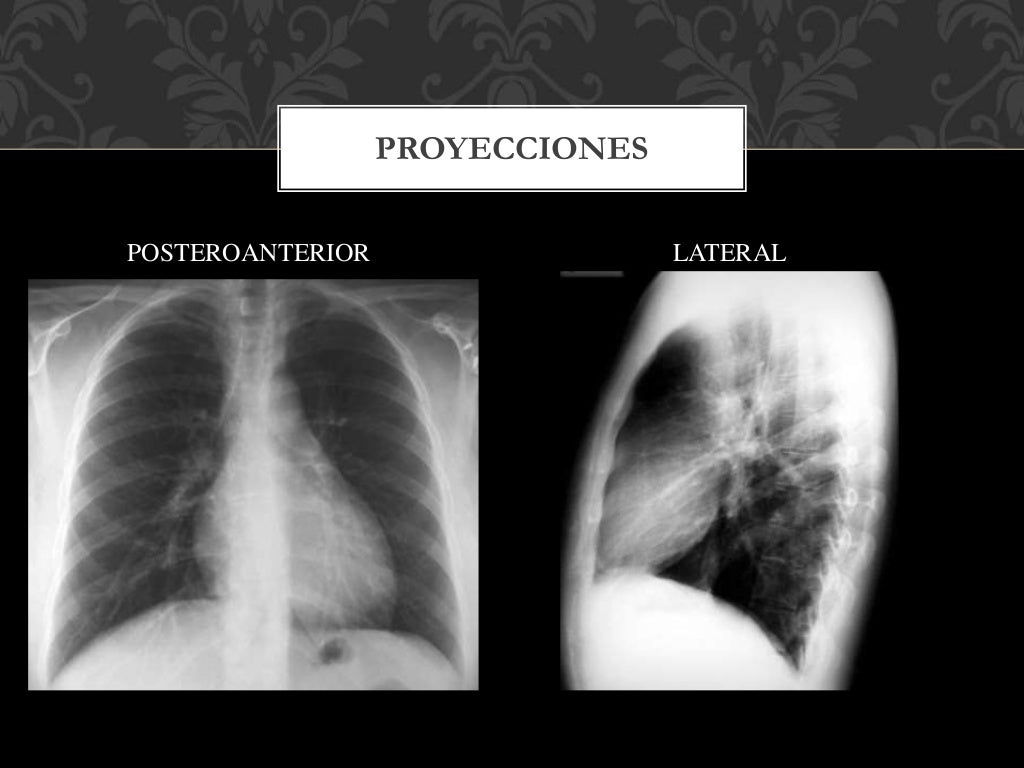 Proyecciones Radiologicas